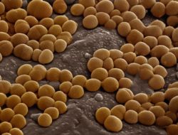 Стафилококи - ето как се заразяваме и лекуваме!