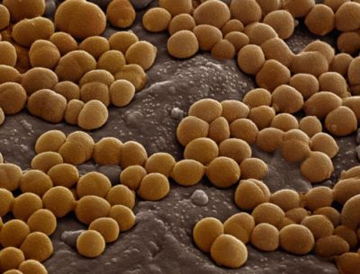 Стафилококи - ето как се заразяваме и лекуваме!