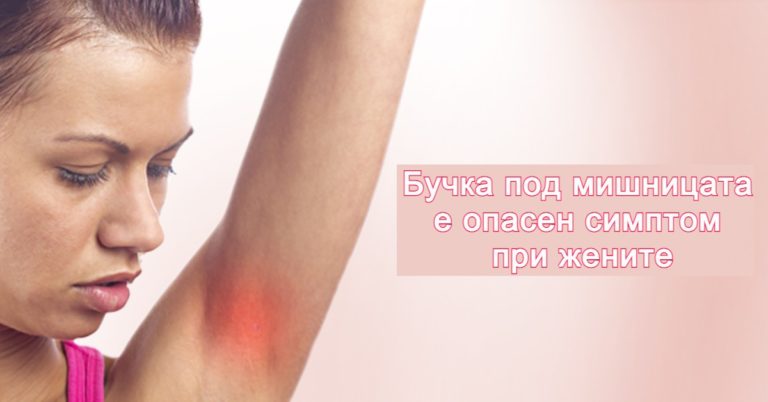 Бучка под мишницата е опасен симптом при жените